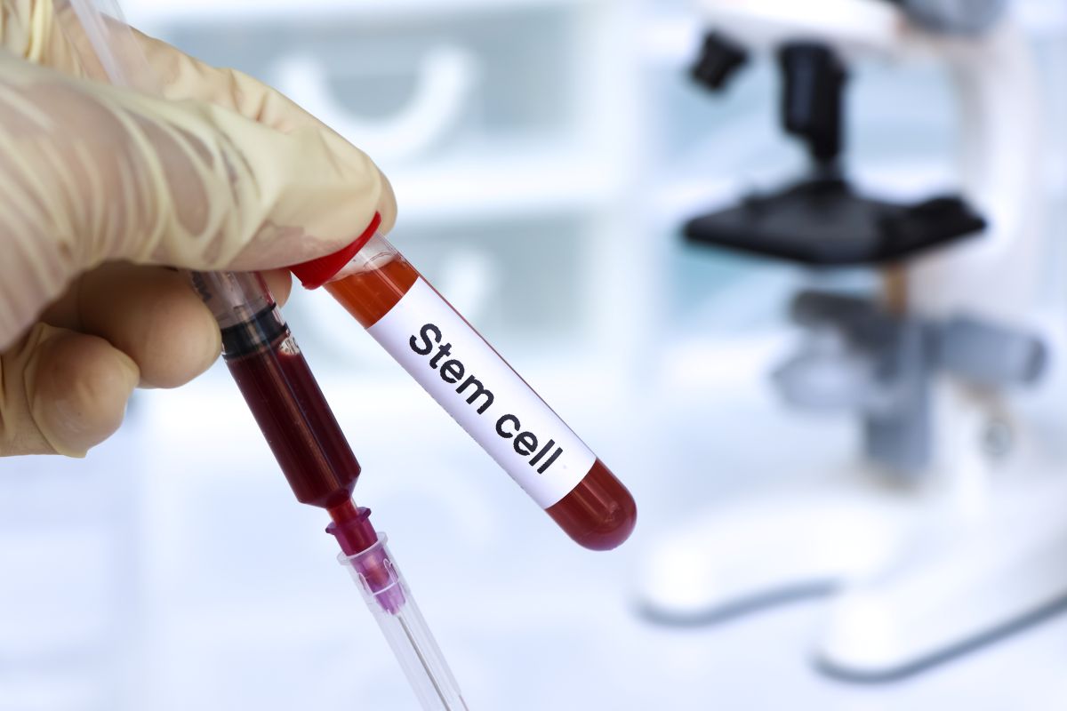 Indonesia Bebas Nyeri 2030, Benarkah Stem Cell Solusinya? | tempo.co